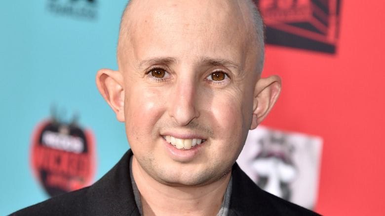 American Horror Story Actor Ben Woolf (Meep) is in STABLE Condition ...